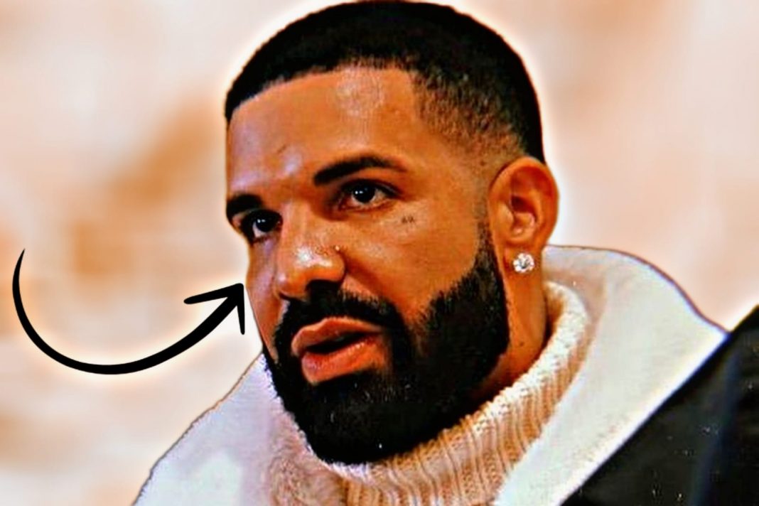 Drake: Biography, His Net Worth, Who is Drake's Wife